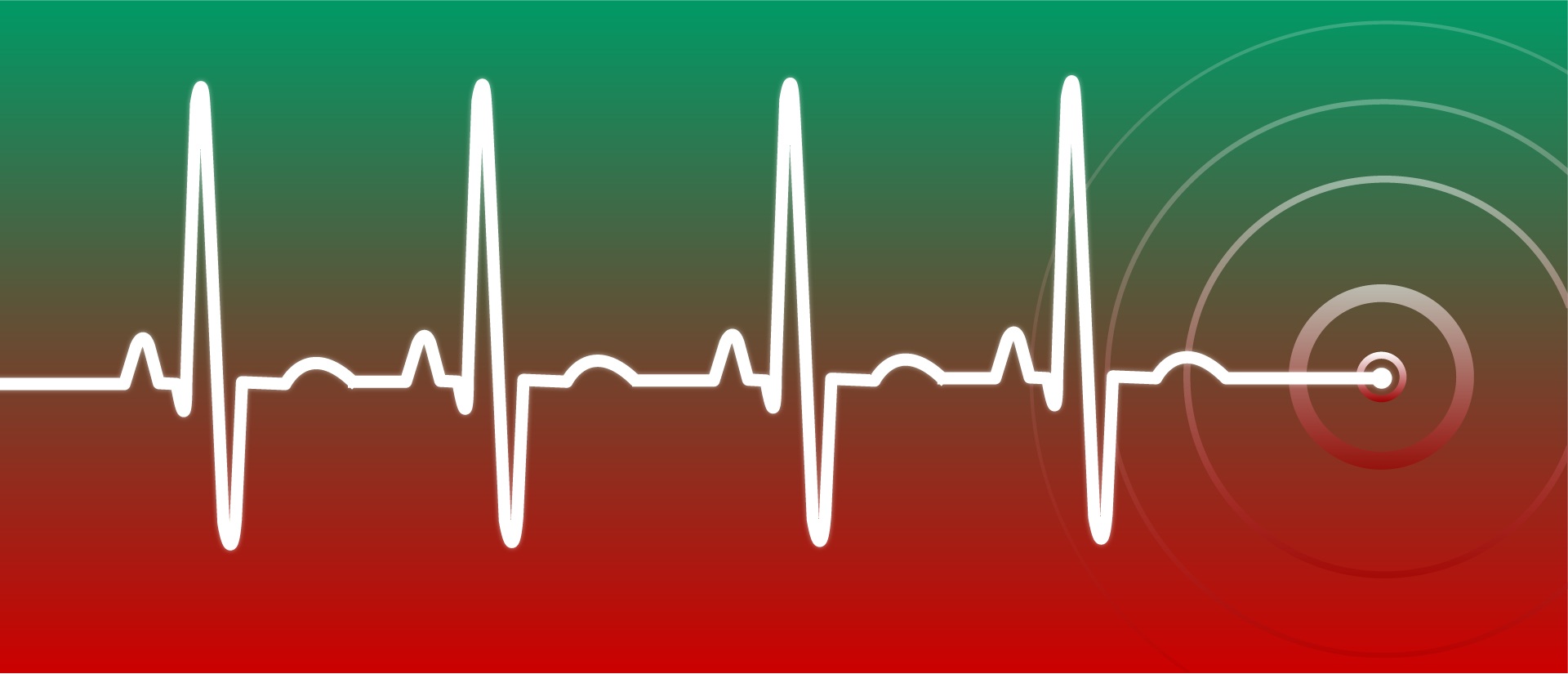 Delta Wave ECG – Why It Should Be The Main Standard For Cardiac Monitors