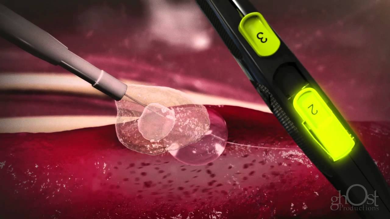 Mynx – What Is It And Why Is It Important?