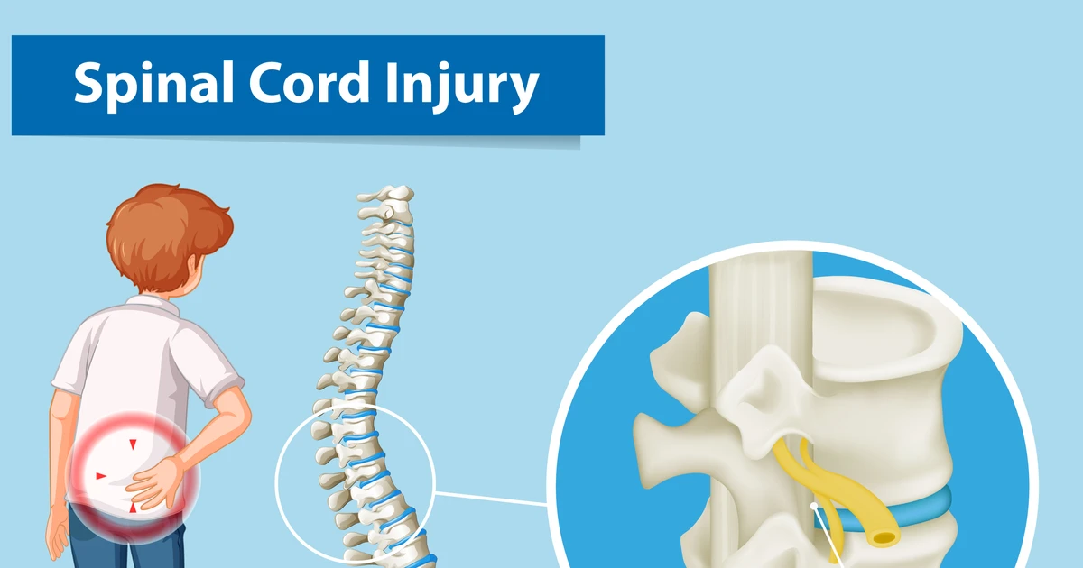 Traumatic Spinal Cord Injury – Injury Mechanism, Diagnosis And Recovery