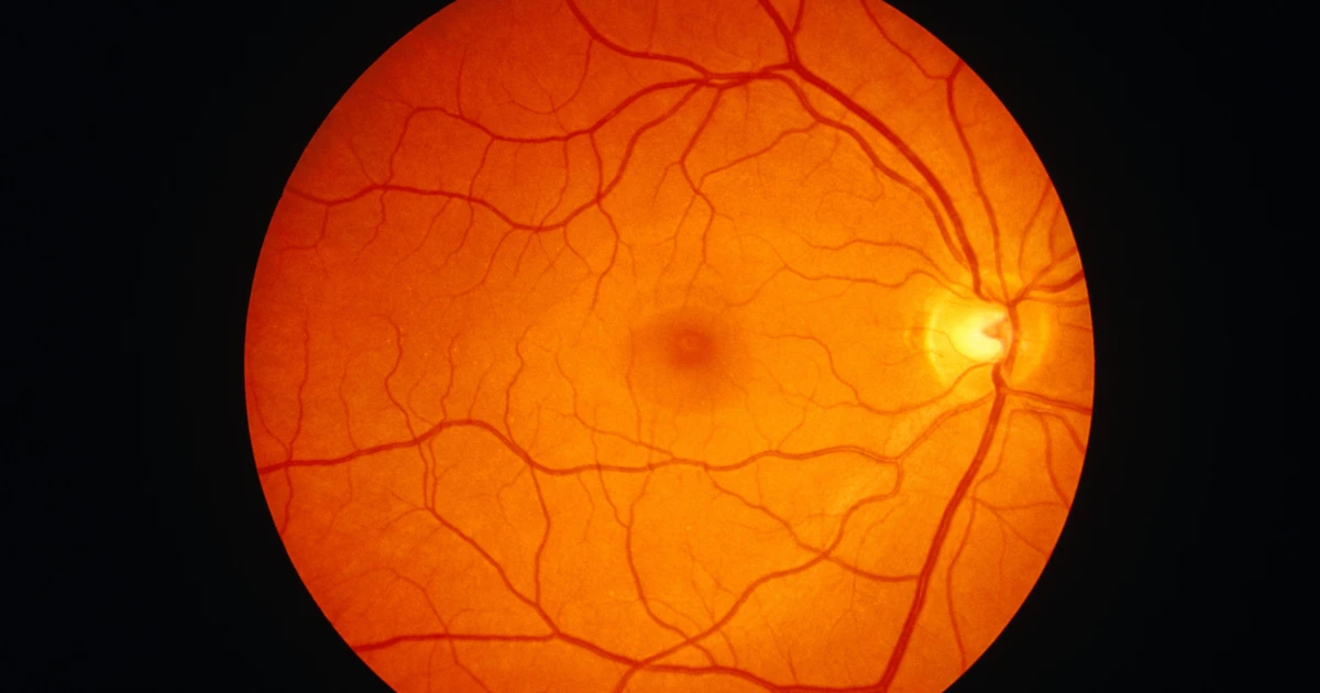 The Human Retina - Intrinsically Photosensitive Ganglion Cells In The ...