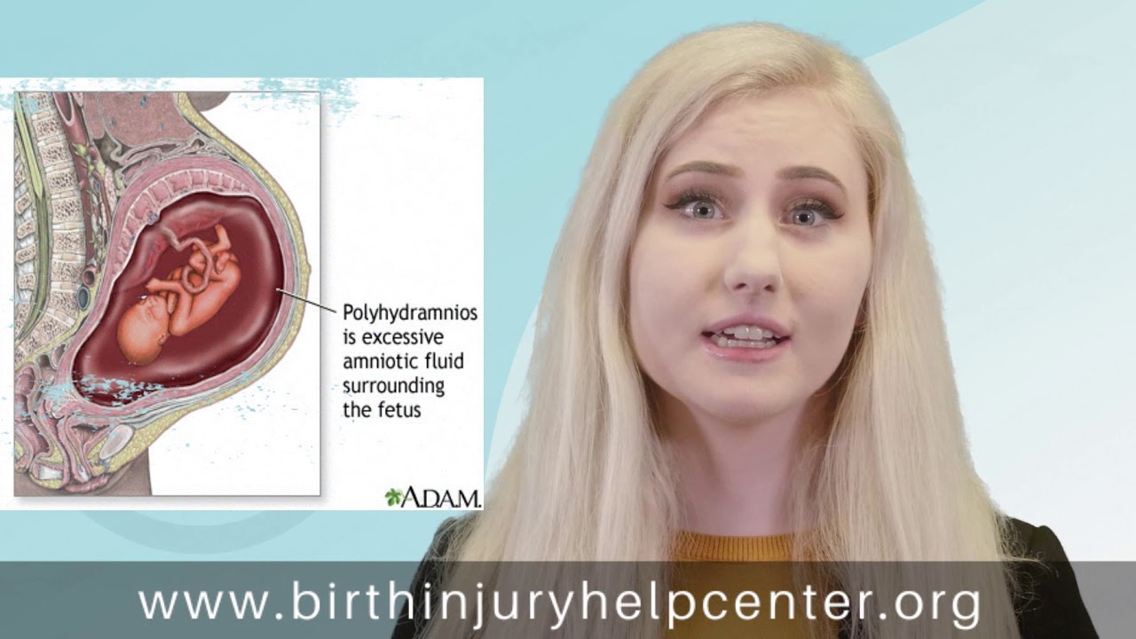 Polyhydramnios In Twin Pregnancy – How Does It Happen? And Its ...