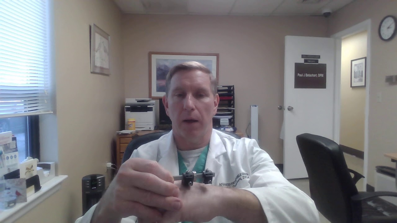 Brachymetatarsia – Most Common Forefoot Deformity And How To Correct It?