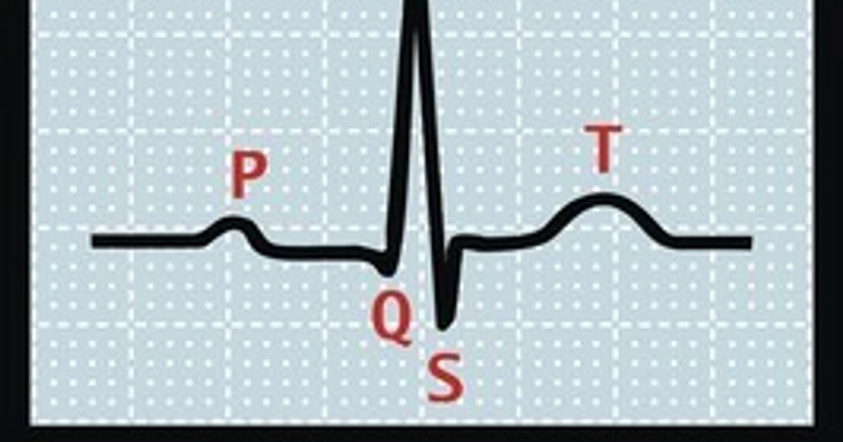 Q Waves - A New Shift In ECG For Heart Problems