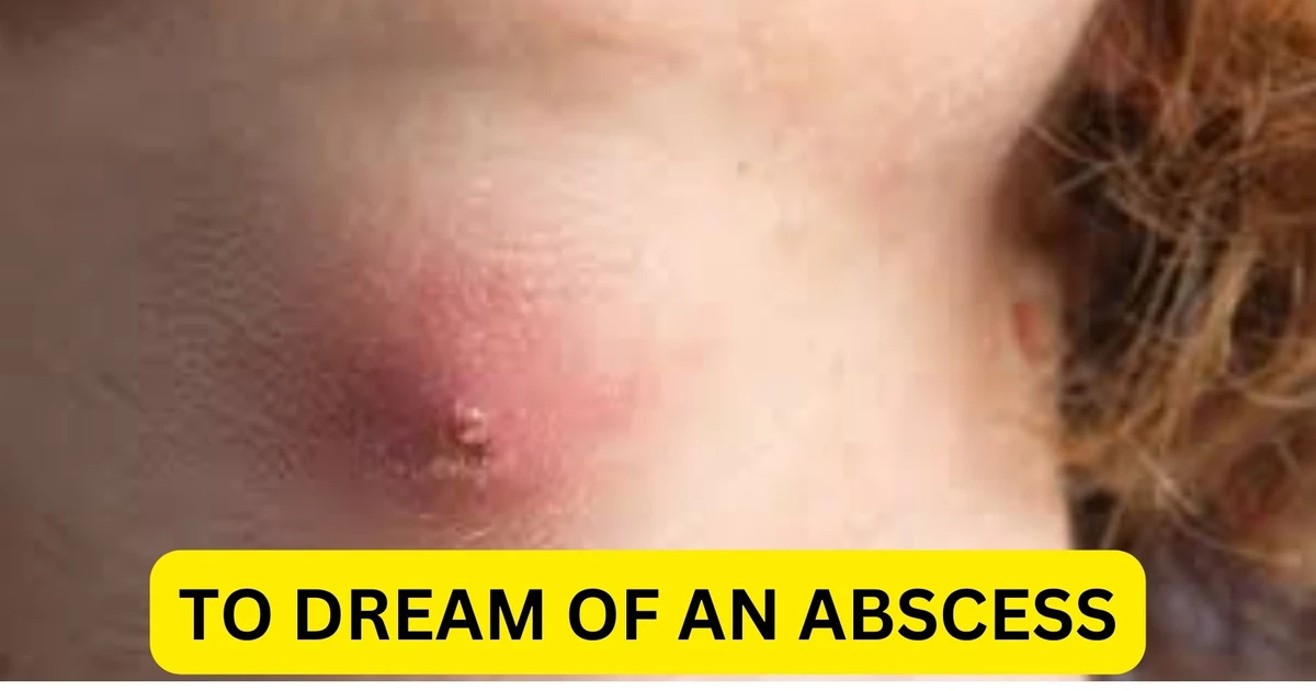To Dream Of An Abscess - An Unfavorable Sign