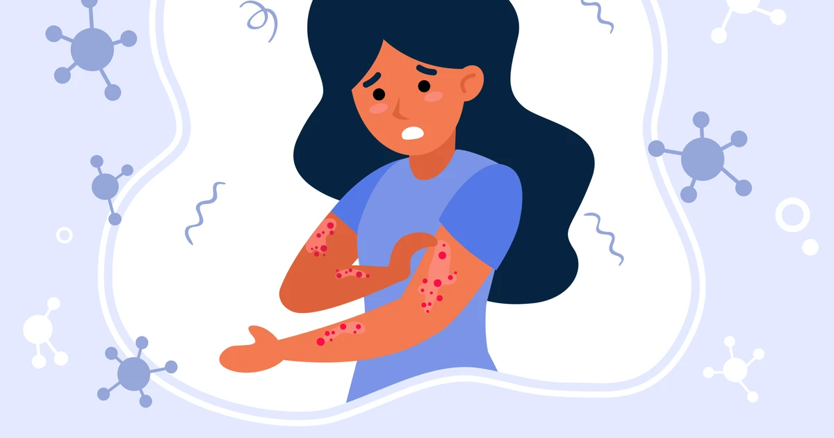 Post Surgery Itching Rash - How To Treat It?