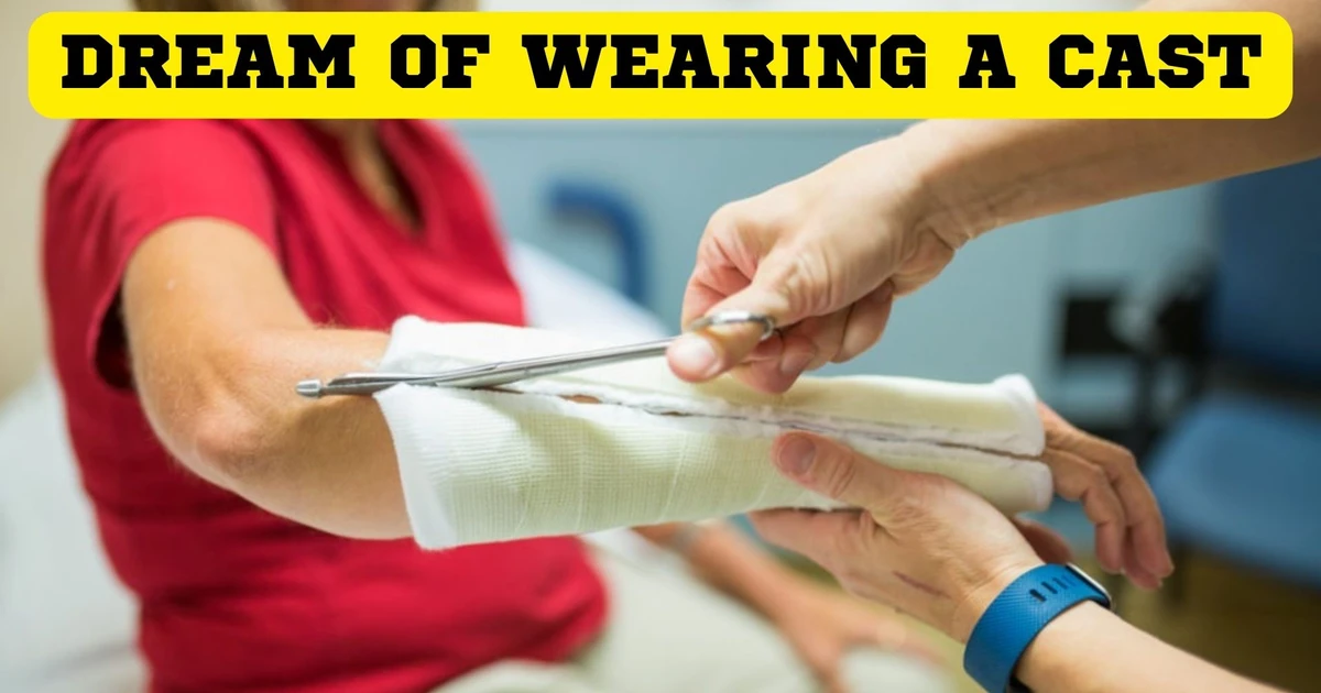 Dream Of Wearing A Cast - It Suggests A Rapid Climb To Success