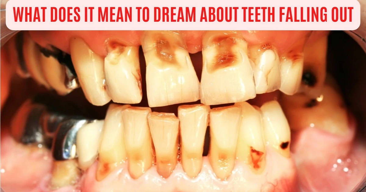 What Does It Mean To Dream About Teeth Falling Out?
