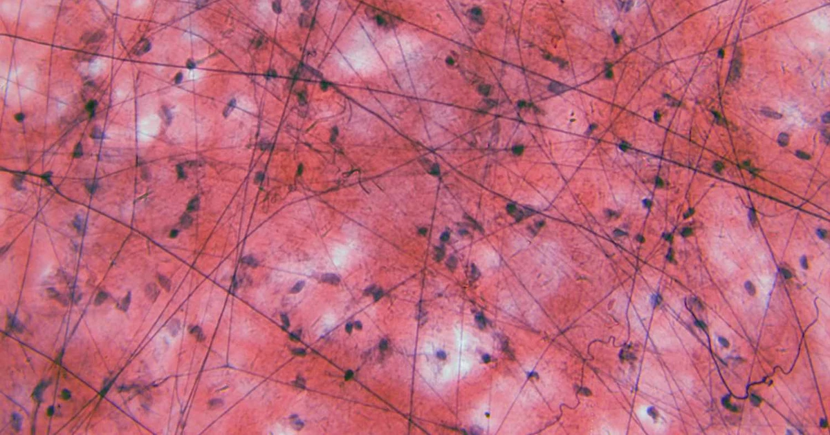 What Is Dealcoholization Of Tissue? A Comprehensive Overview