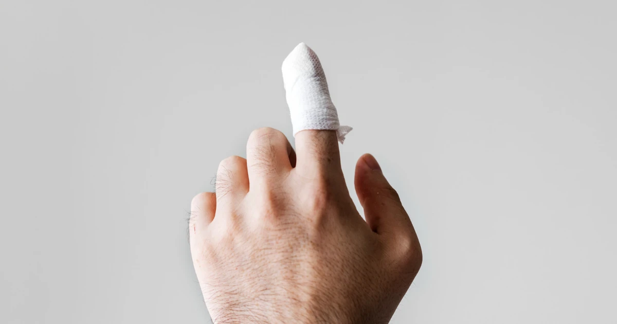 How Long Does It Take To Recover From A Finger Amputation?