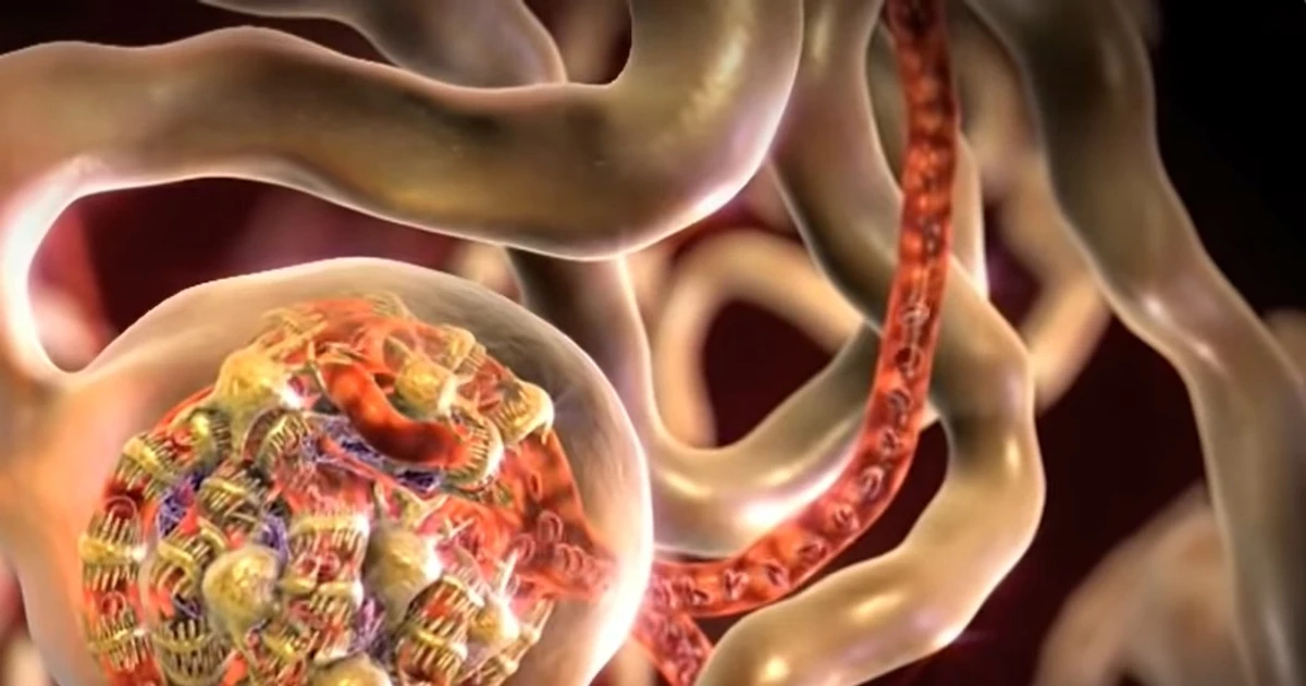 Extra-Immunological Role Of Complement Activation In Diabetic Nephropathy